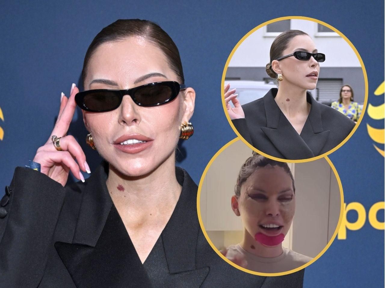 Julia von Stein zadebiutowała z nową twarzą. Warto było iść pod nóż? - Super Express ...