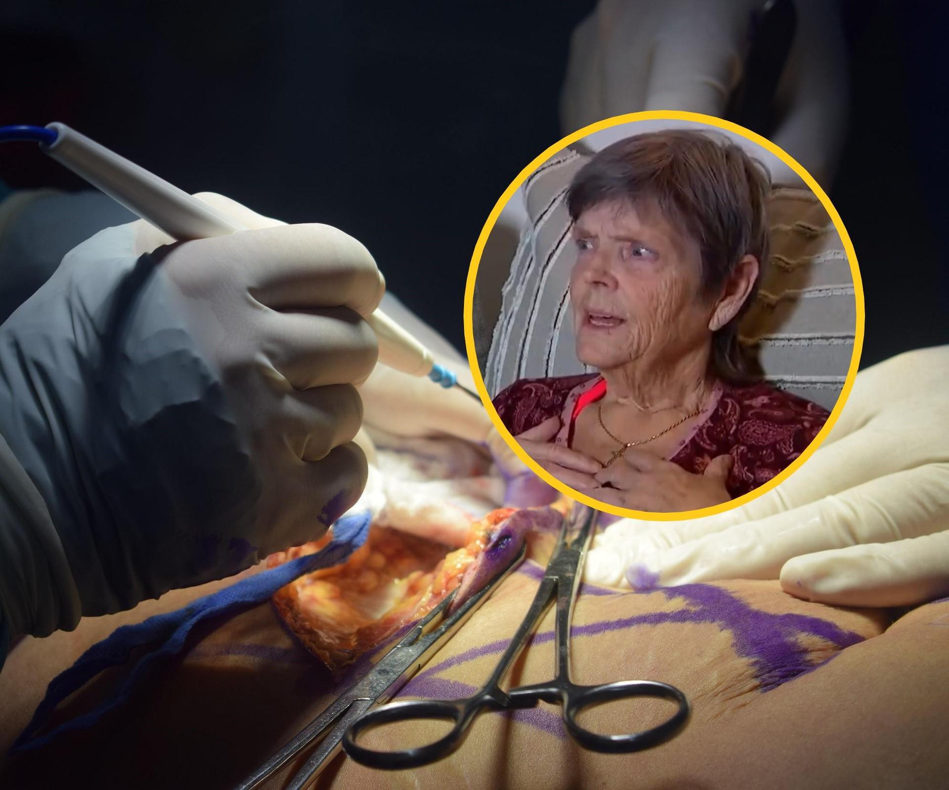 Kimberly McCormick. 65-latka poddała się wygładzaniu skóry. Zabieg ...