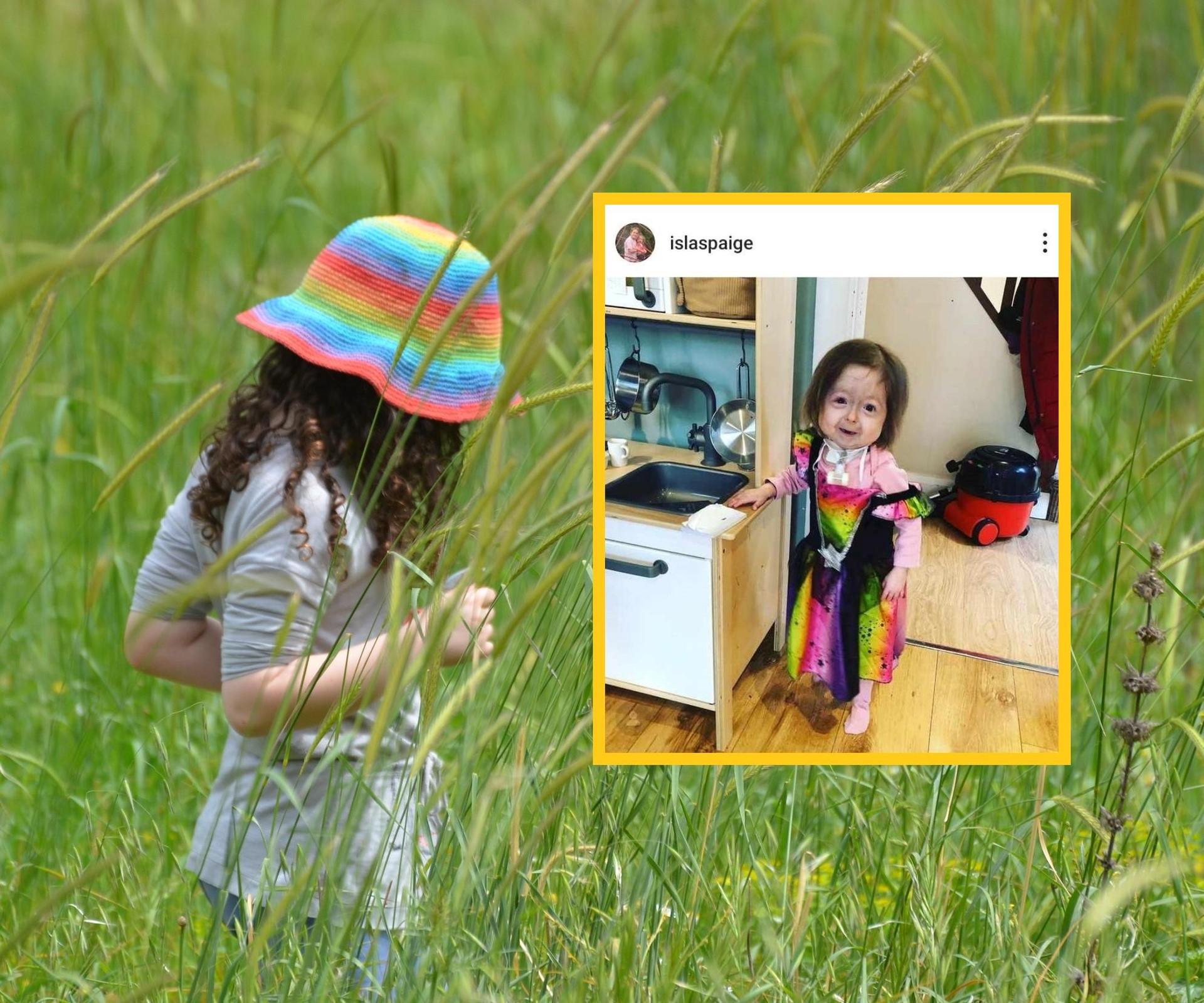 Isla Kilpatrick-Screaton. Mając 2 lata wyglądała jak staruszka. Jedyna ...