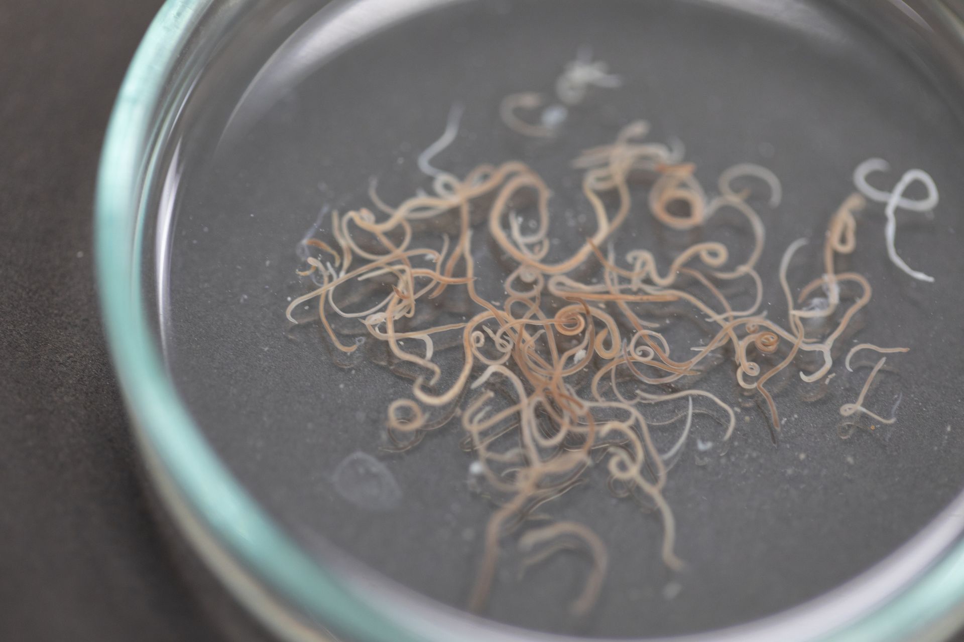 Glista ludzka - PoradnikZdrowie.pl