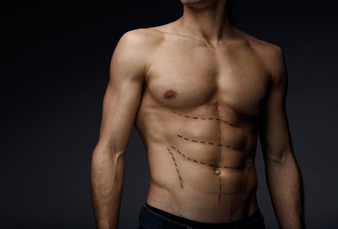 Mięśnie brzucha - podział, anatomia, funkcje - PoradnikZdrowie.pl