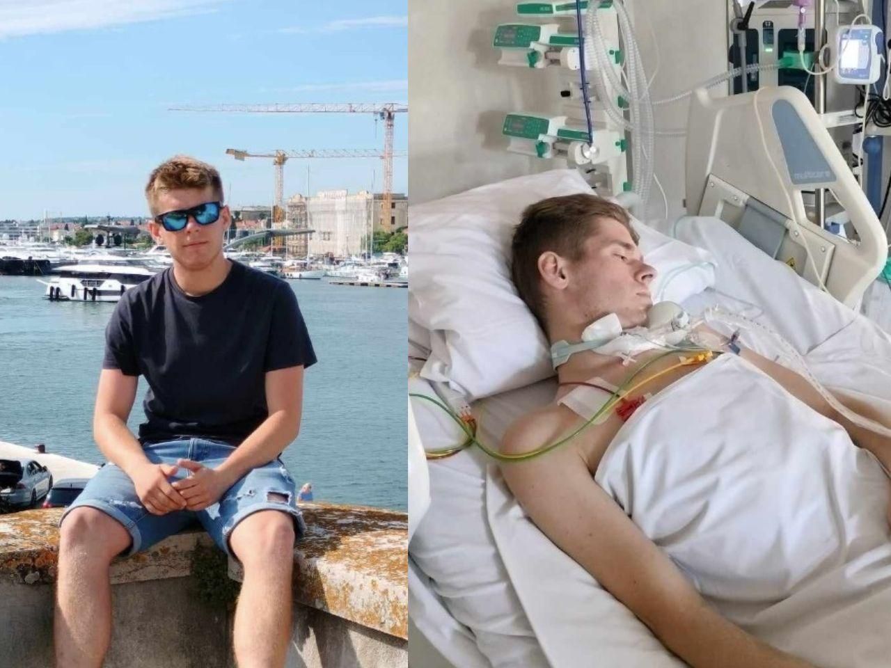 Rodzice 22-latka pobitego na festiwalu w Sławie apelują o pomoc. "Jest zdany tylko na nas ...