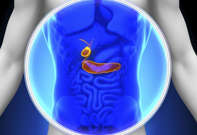 Torbiele trzustki – przyczyny, objawy i leczenie - PoradnikZdrowie.pl
