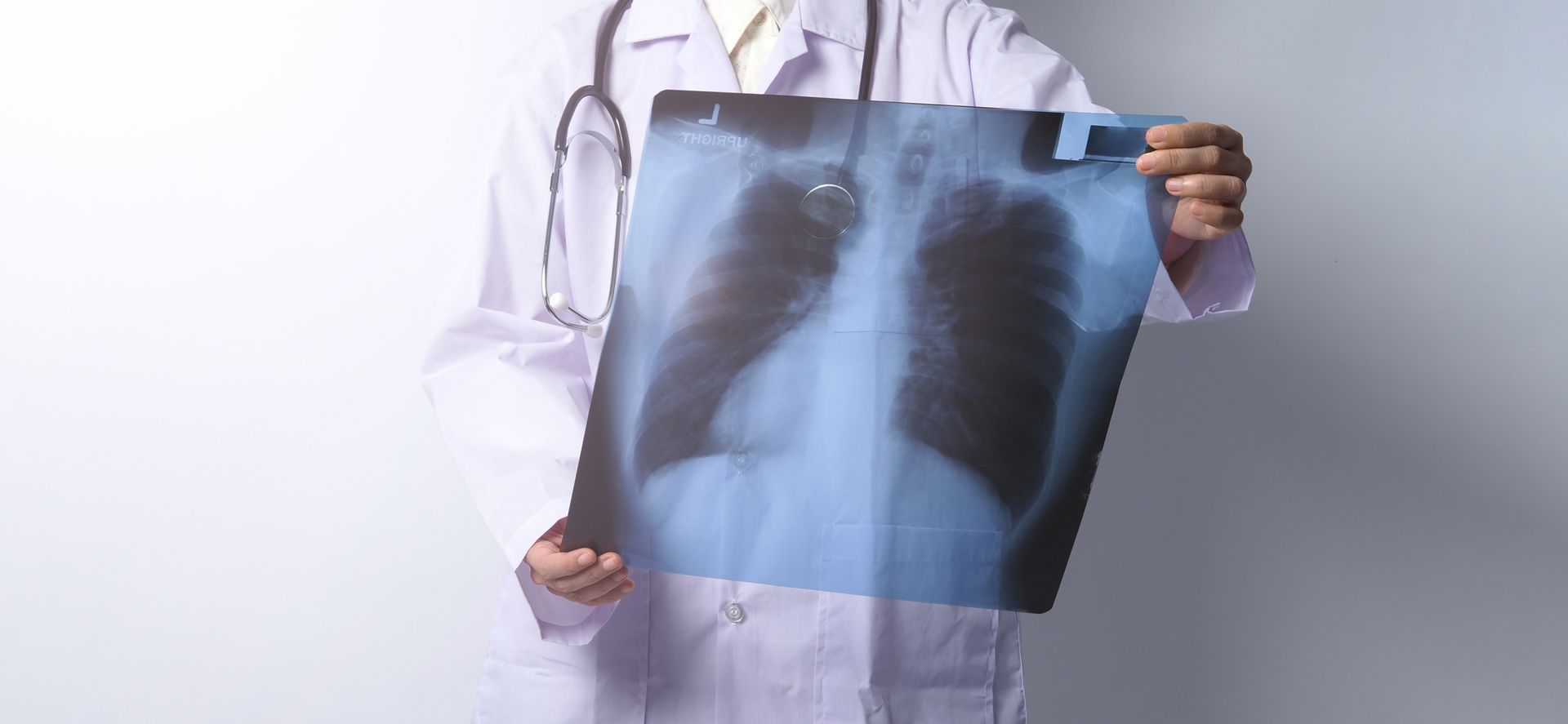 Rak płuc - przyczyny, objawy, diagnostyka - PoradnikZdrowie.pl