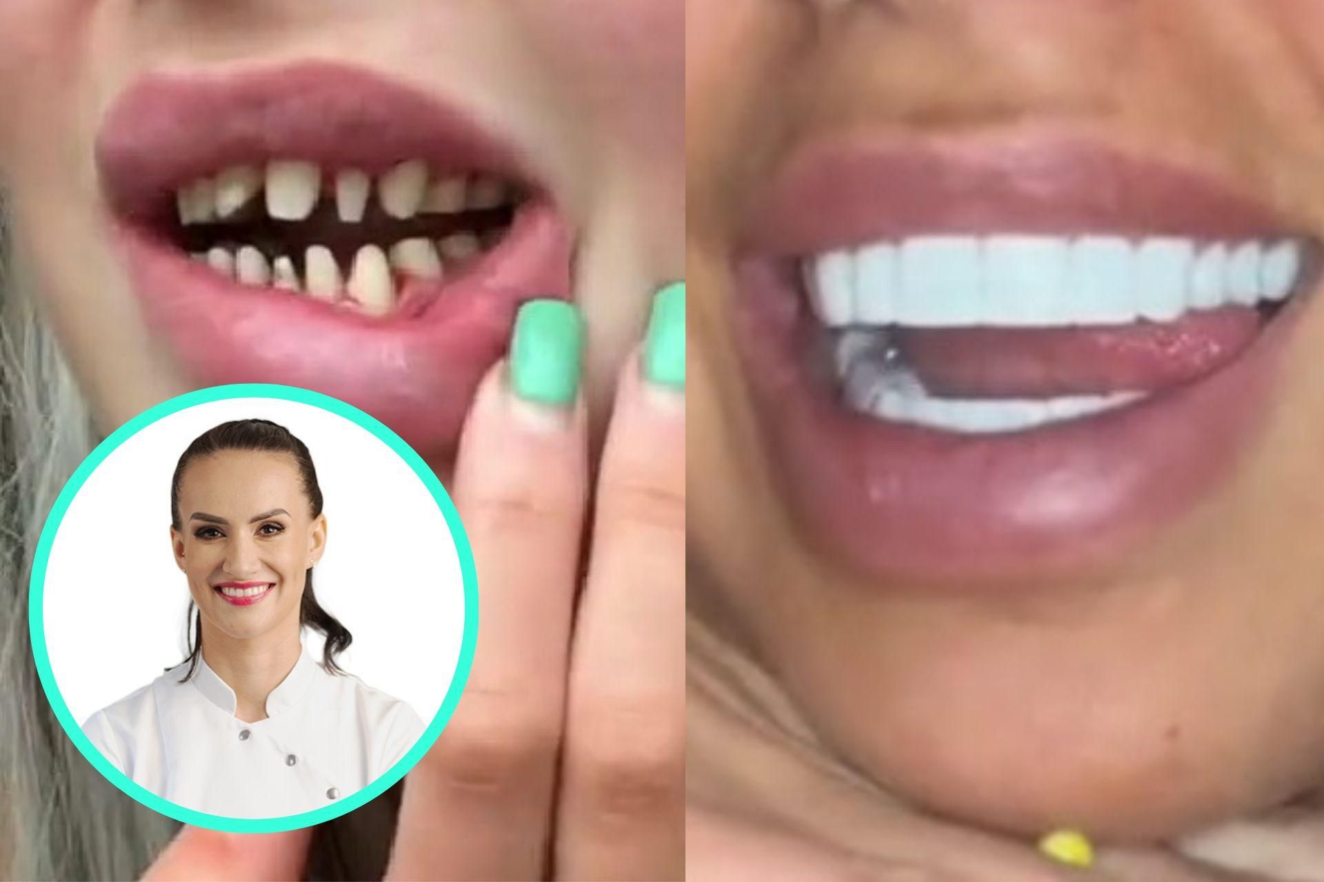 Z "tureckimi zębami" wracają do polskich stomatologów. "Widzimy zęby ...