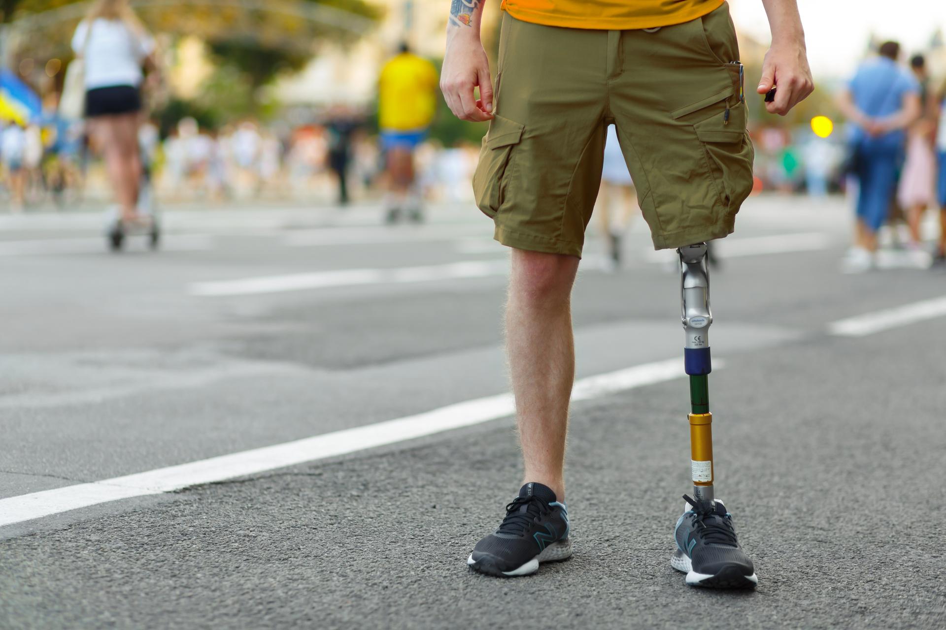 Pomoc dla tych, którym wojna urwała nogi. Nowe życie z protezą - Portal ...