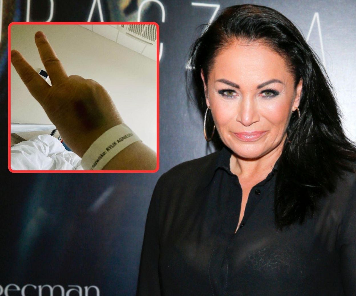 Problemy zdrowotne Agnieszki Rylik. Pięściarka zdradziła na Facebooku ...