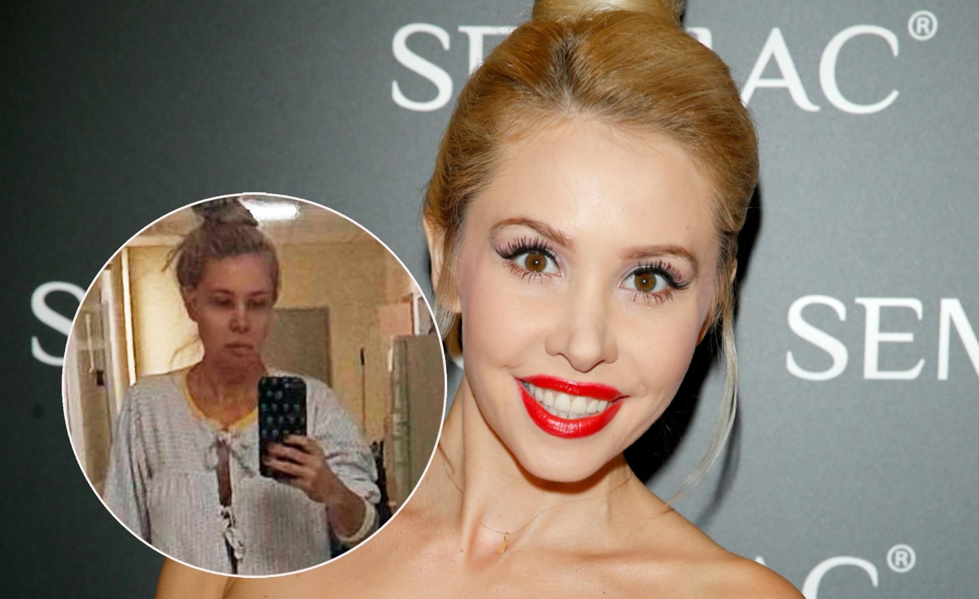 Koszmar Ewy Lubert. Miała 11-centymetrowego mięśniaka, zdradziła, co ...