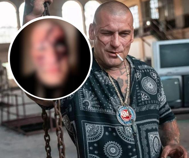 Popek ma nowy tatuaż na twarzy! Kreski, wielka plama i wulgarny napis ...