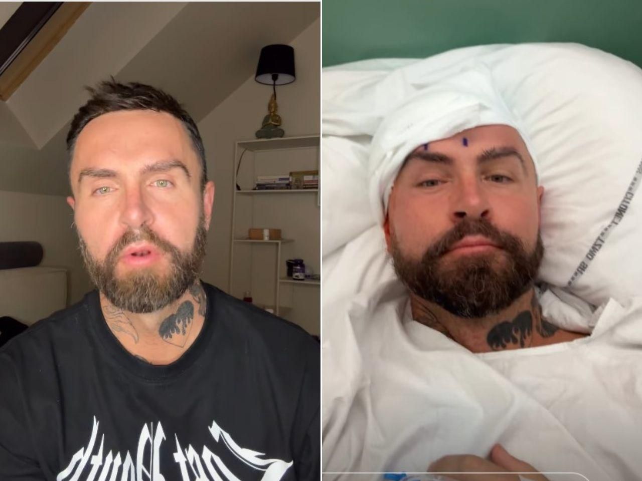 Łukasz Urbański jest już po operacji usunięcia guza mózgu. Jak się ...