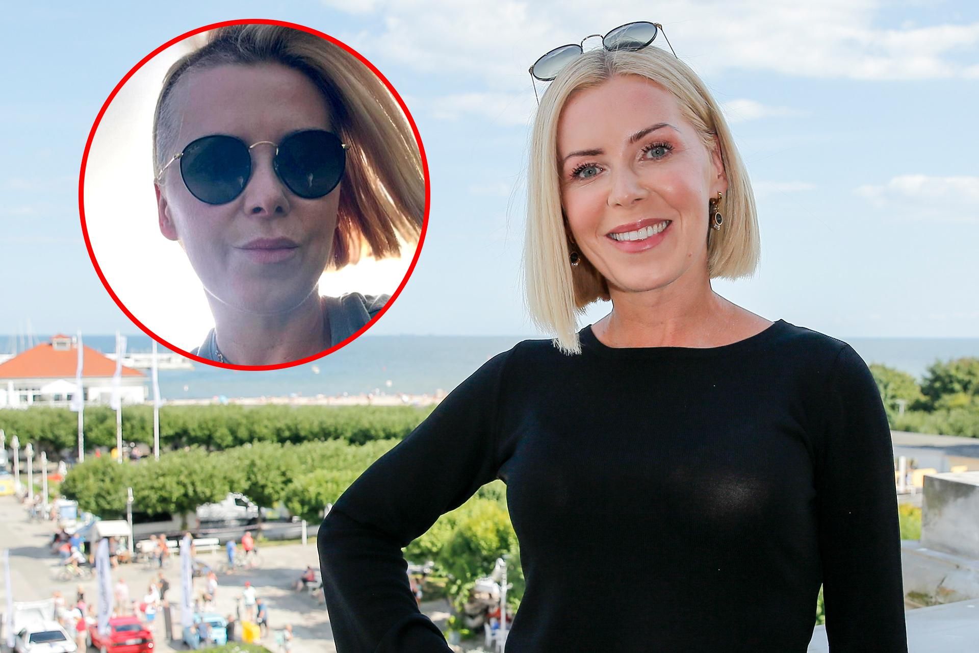 Prezenterka TVN z wygoloną połową głowy. Pisze o operacji guza mózgu ...