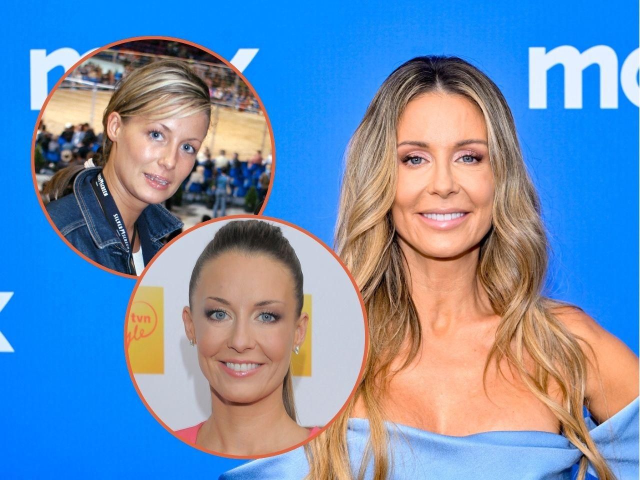 Małgorzata Rozenek-Majdan o operacjach plastycznych. "Nie da się od ...