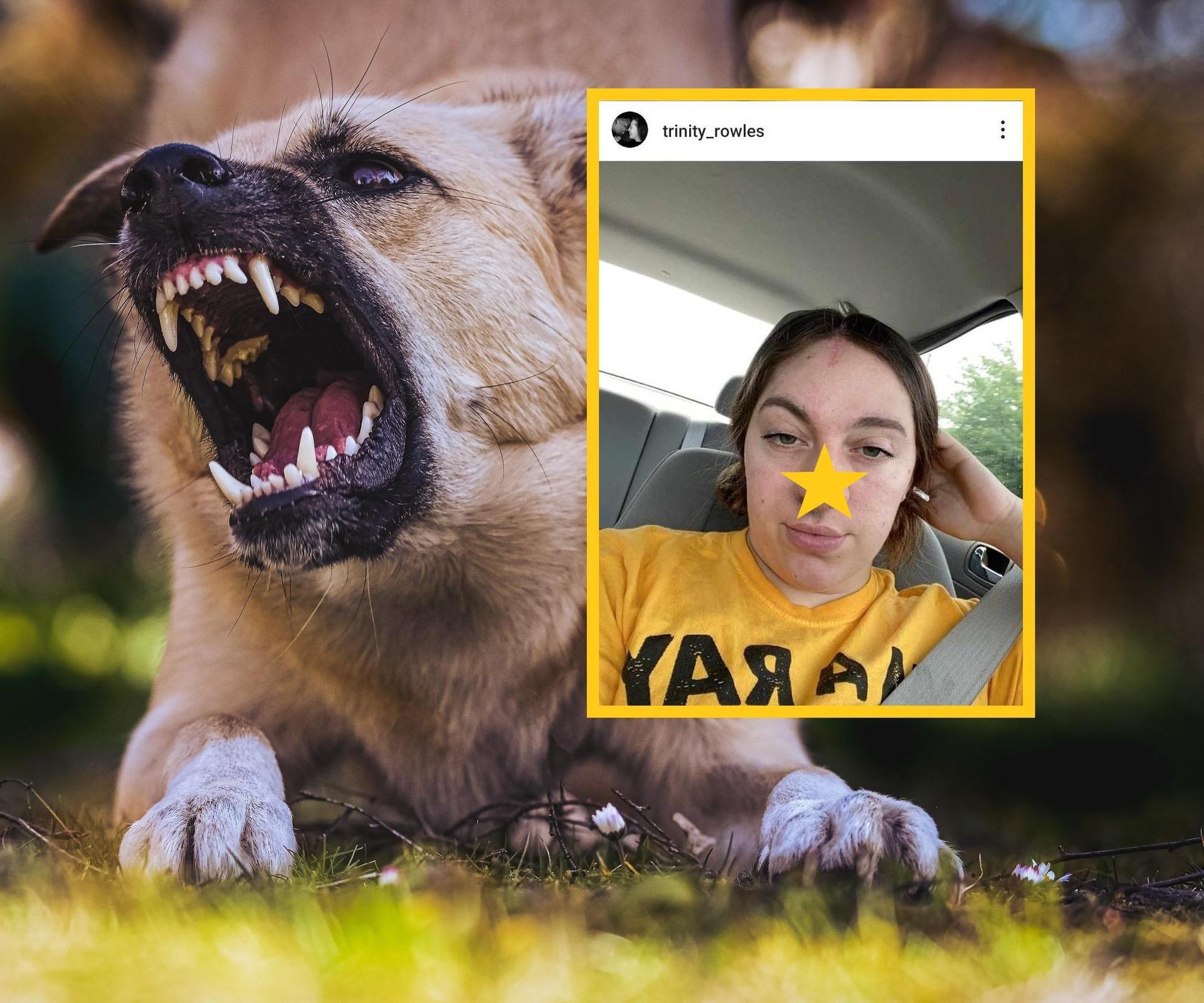 Trinity Rowles. Po ataku psa ma „włochaty nos”. Musi golić go dwa razy ...