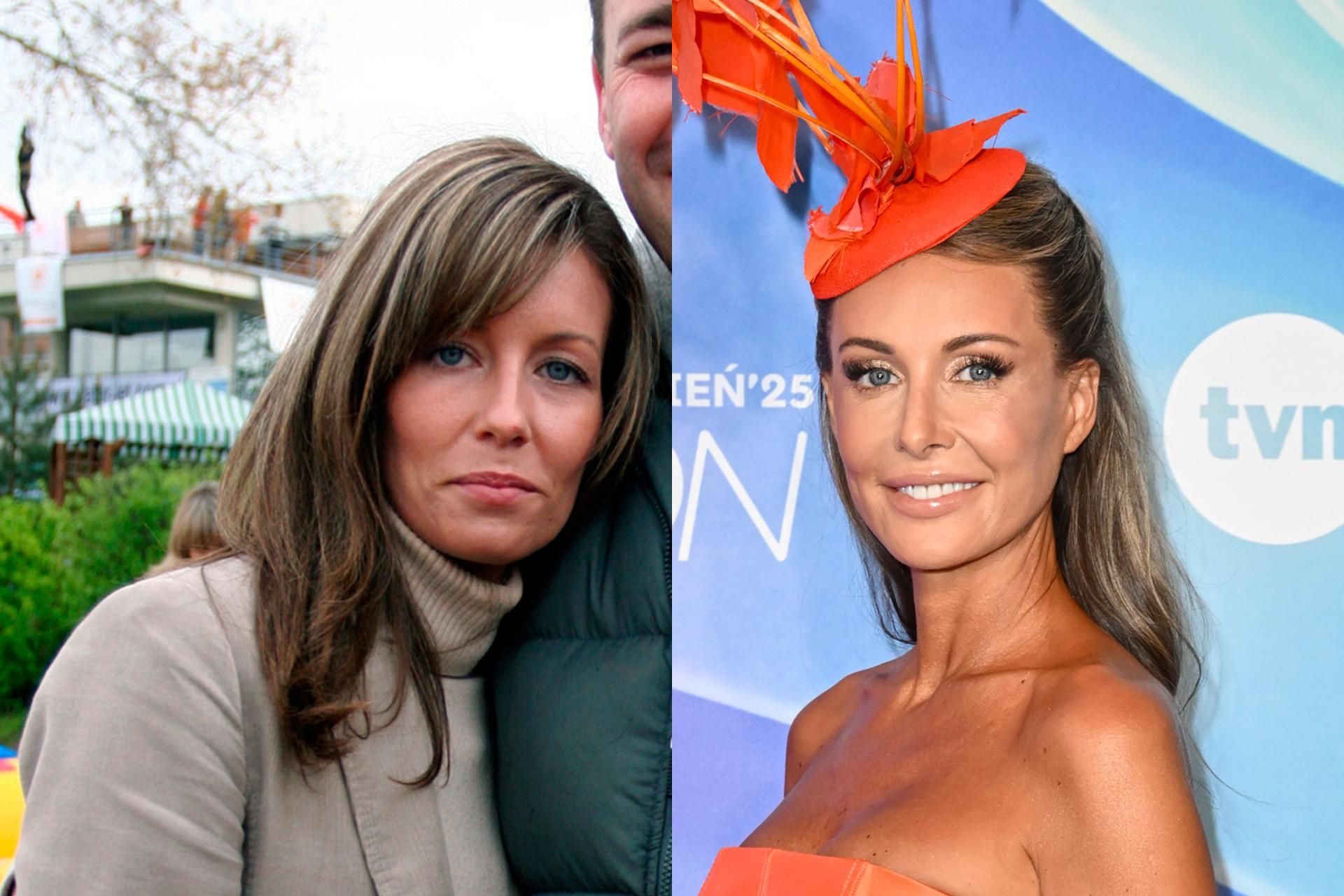 Małgorzata Rozenek-Majdan o poprawianiu urody. "Moja metamorfoza nie ...