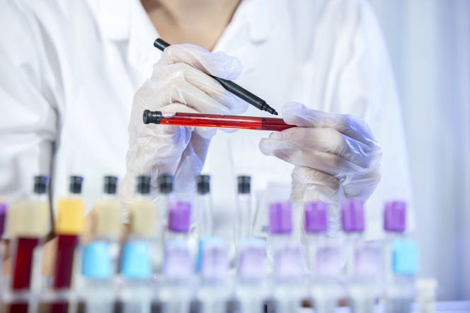 Neutrofile: morfologia krwi. Neutrofile poniżej i powyżej normy ...