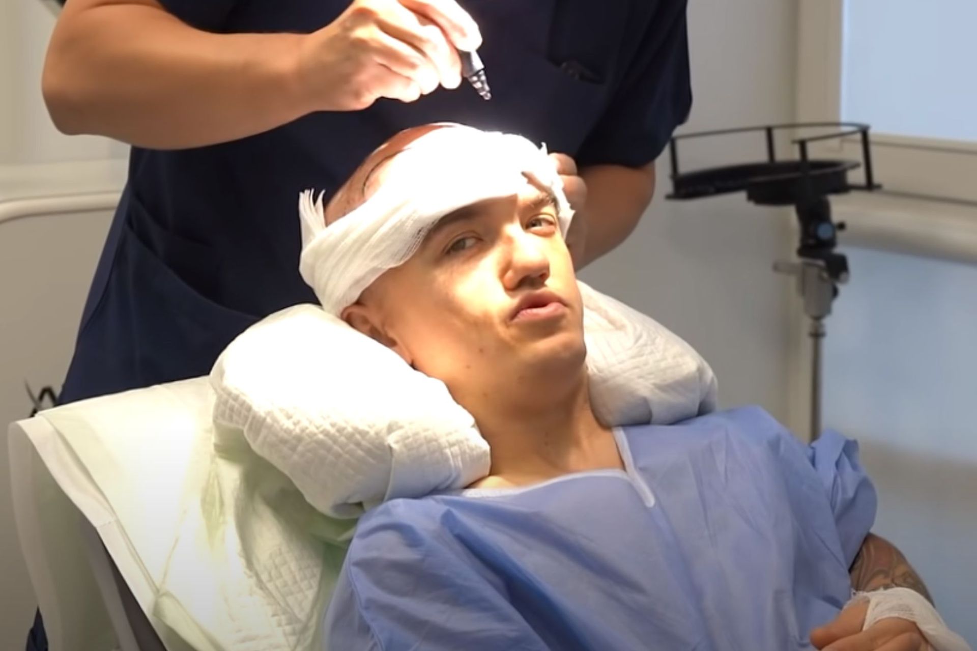 Mini Majk pokazał jak wyglądał przed przeszczepem włosów. Różnica jest ...