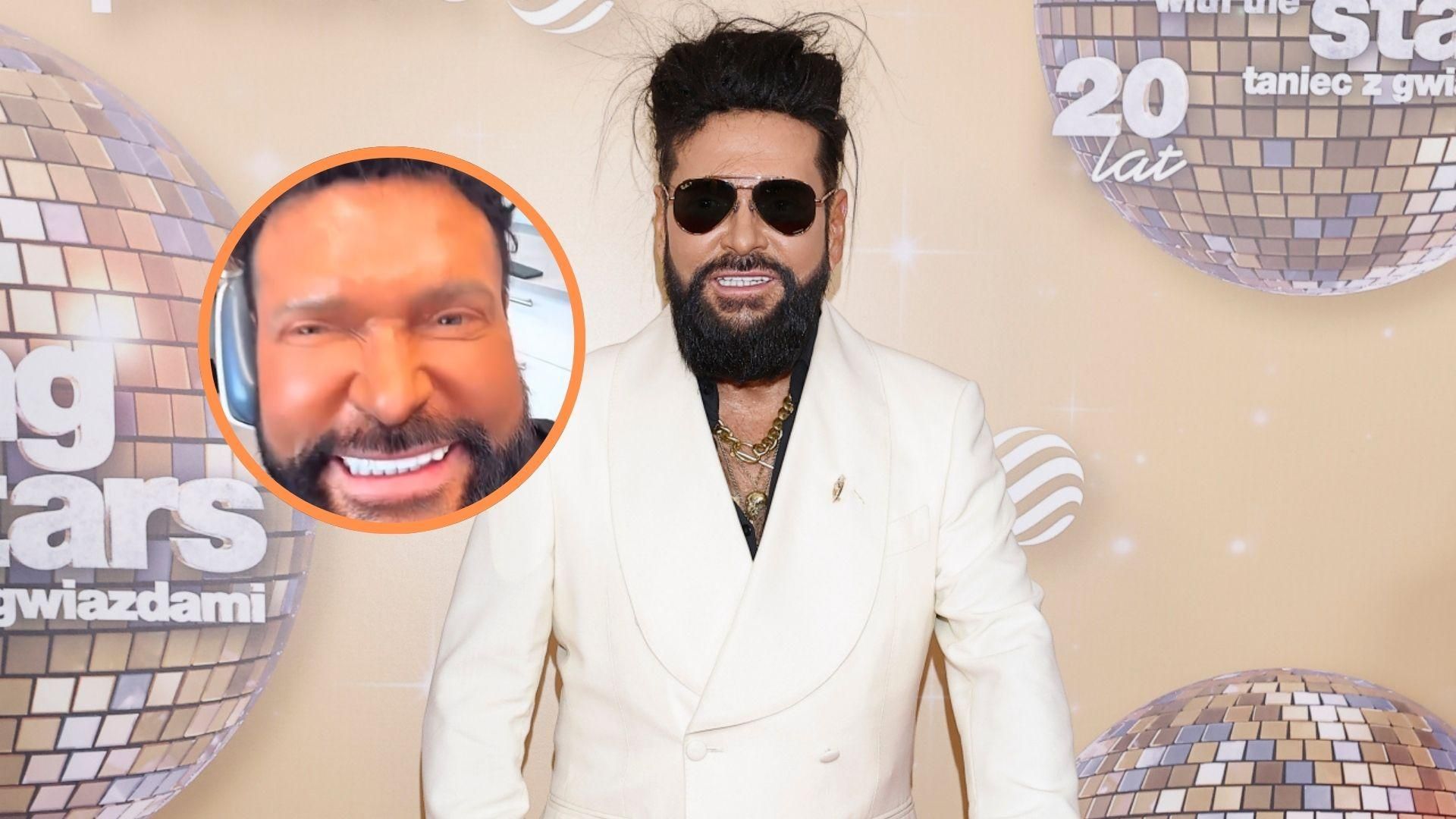 Krzysztof Rutkowski i jego nowe zęby. Zdania fanów? Podzielone - ESKA.pl